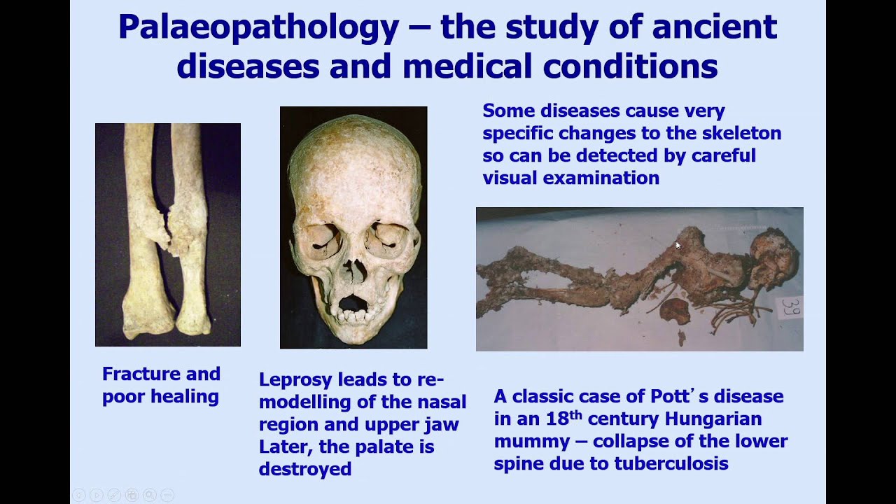 The Evolutionary War Between Man And Disease | Rotary Club of Hawthorn
