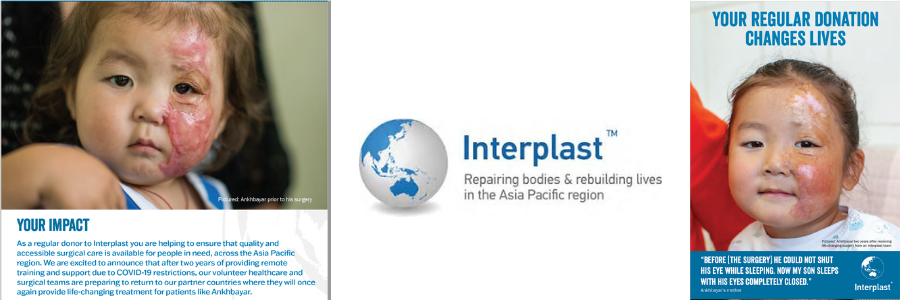 Interplast | Rotary District 9780